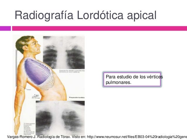 Anatomía de tórax y radiología de tórax normal