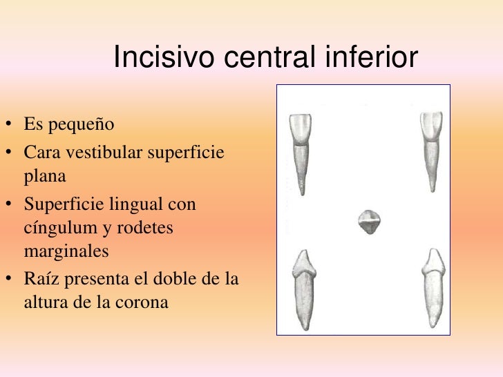 Anatomía dientes temporales