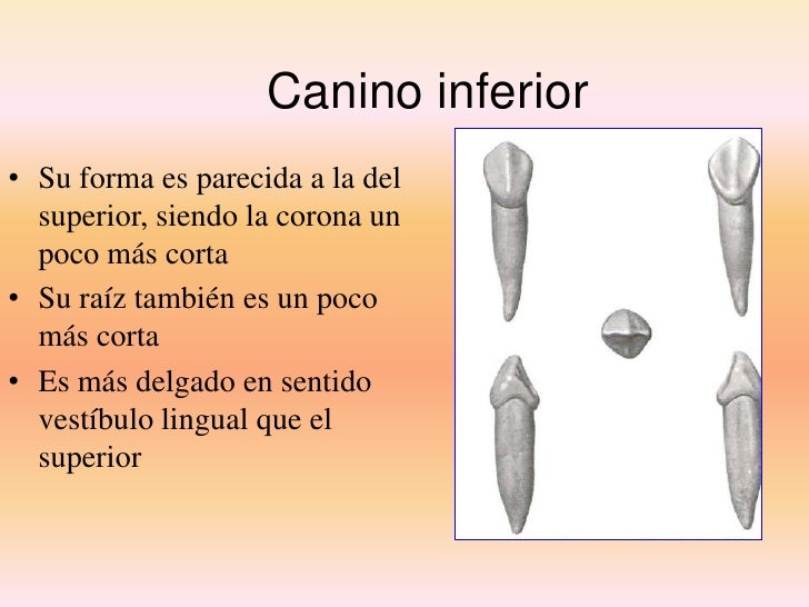 Anatomía dientes temporales