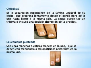 Anatomía, fisiología y alteración de las uñas | PPTX
