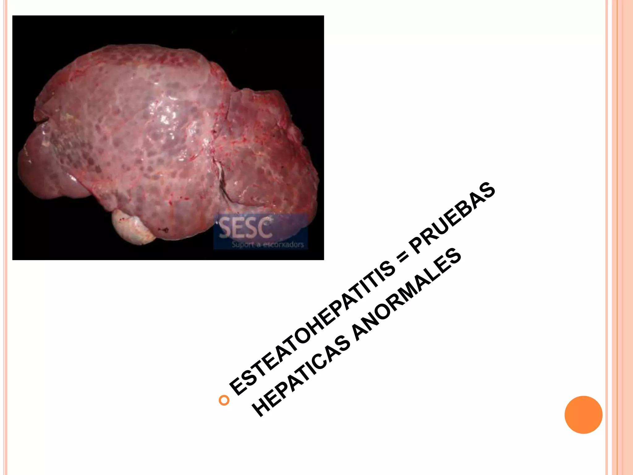 Anatomía hepática y sus principales patologías.pptx