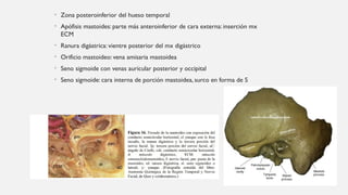 ANATOMÍA DEHUESO TEMPORAL OTORRINOLARINGOLOGIA.pptx