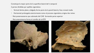ANATOMÍA DEHUESO TEMPORAL OTORRINOLARINGOLOGIA.pptx