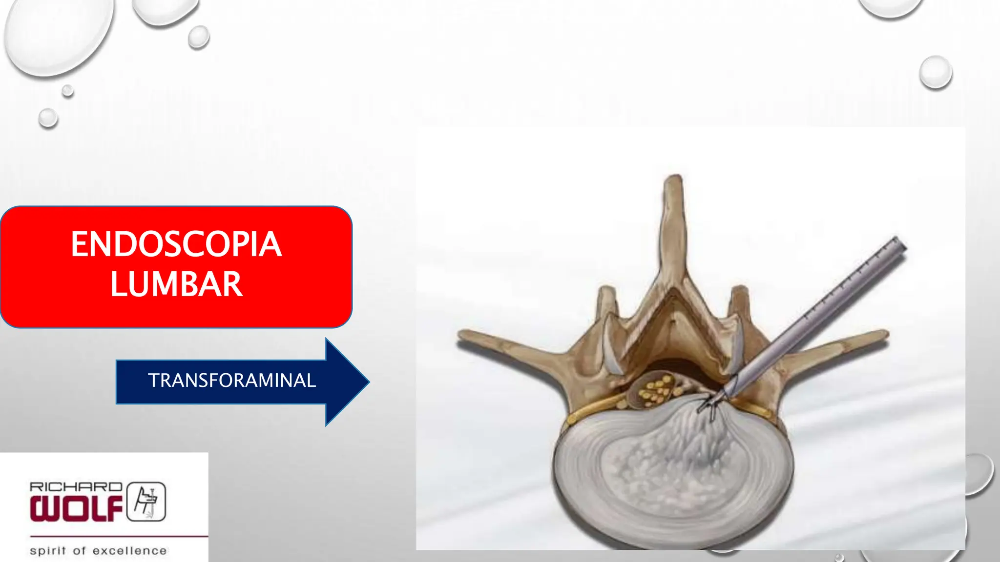 ANATOMÍA LUMBOSACRO-ENDOSCOPÍA LUMBAR.pptx