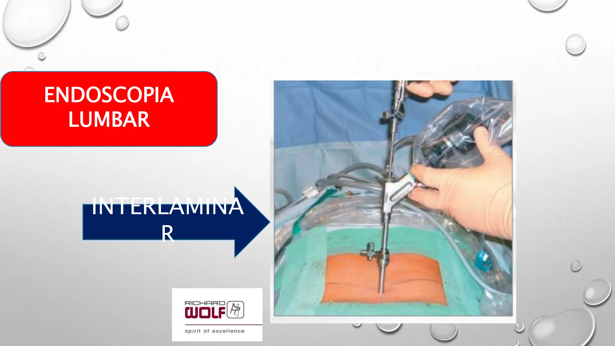 ANATOMÍA LUMBOSACRO-ENDOSCOPÍA LUMBAR.pptx