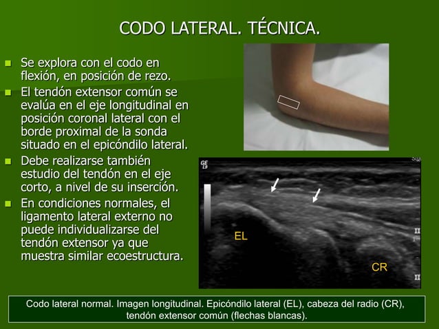 anatoma_normal_del_codo.ppt
