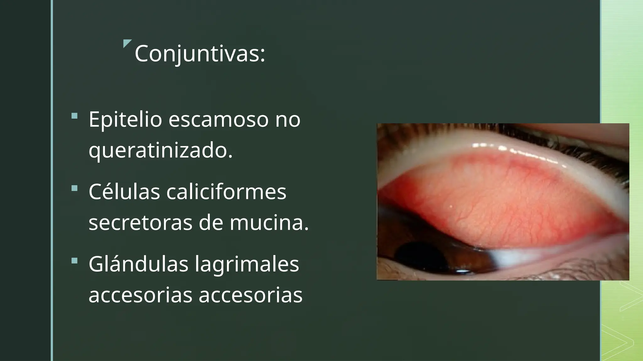Anatomía de párpados y pestañas (oftalmología) | PPTX | Eye and Vision ...