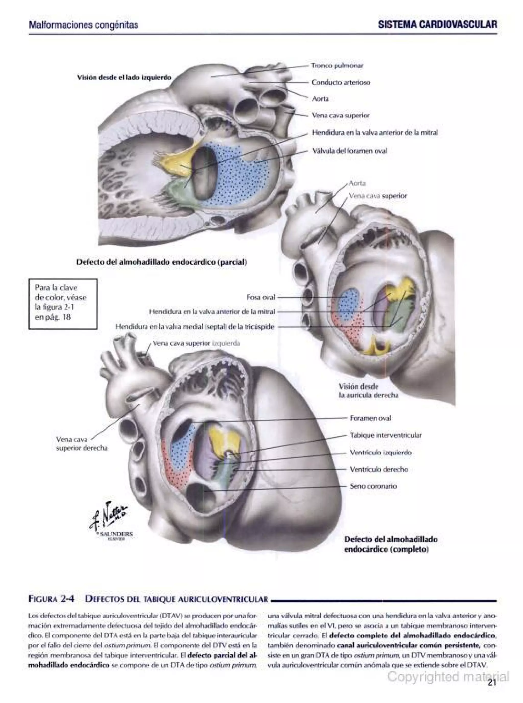 Anatomía Patólogica - Netter.pdf