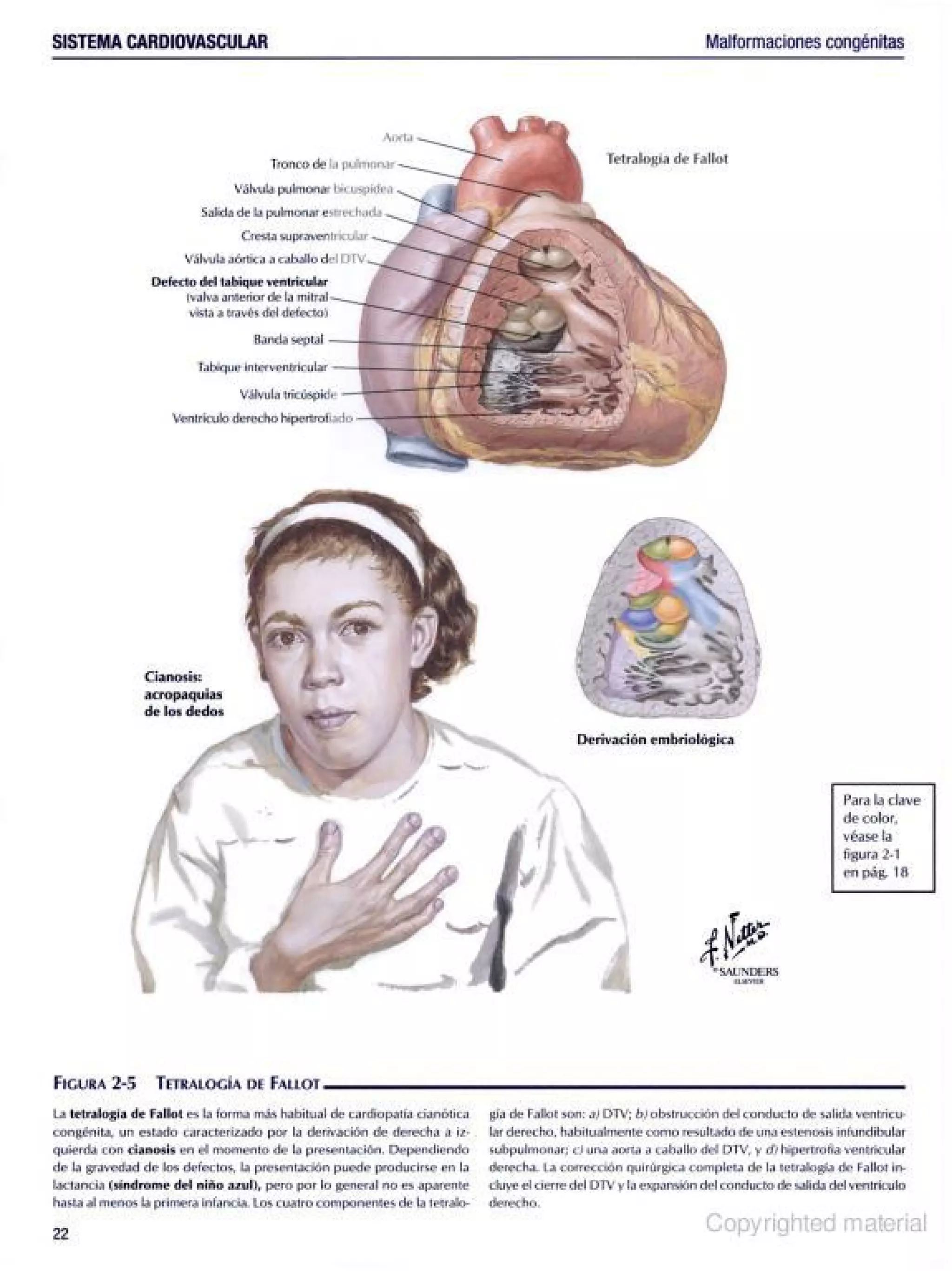 Anatomía Patólogica - Netter.pdf