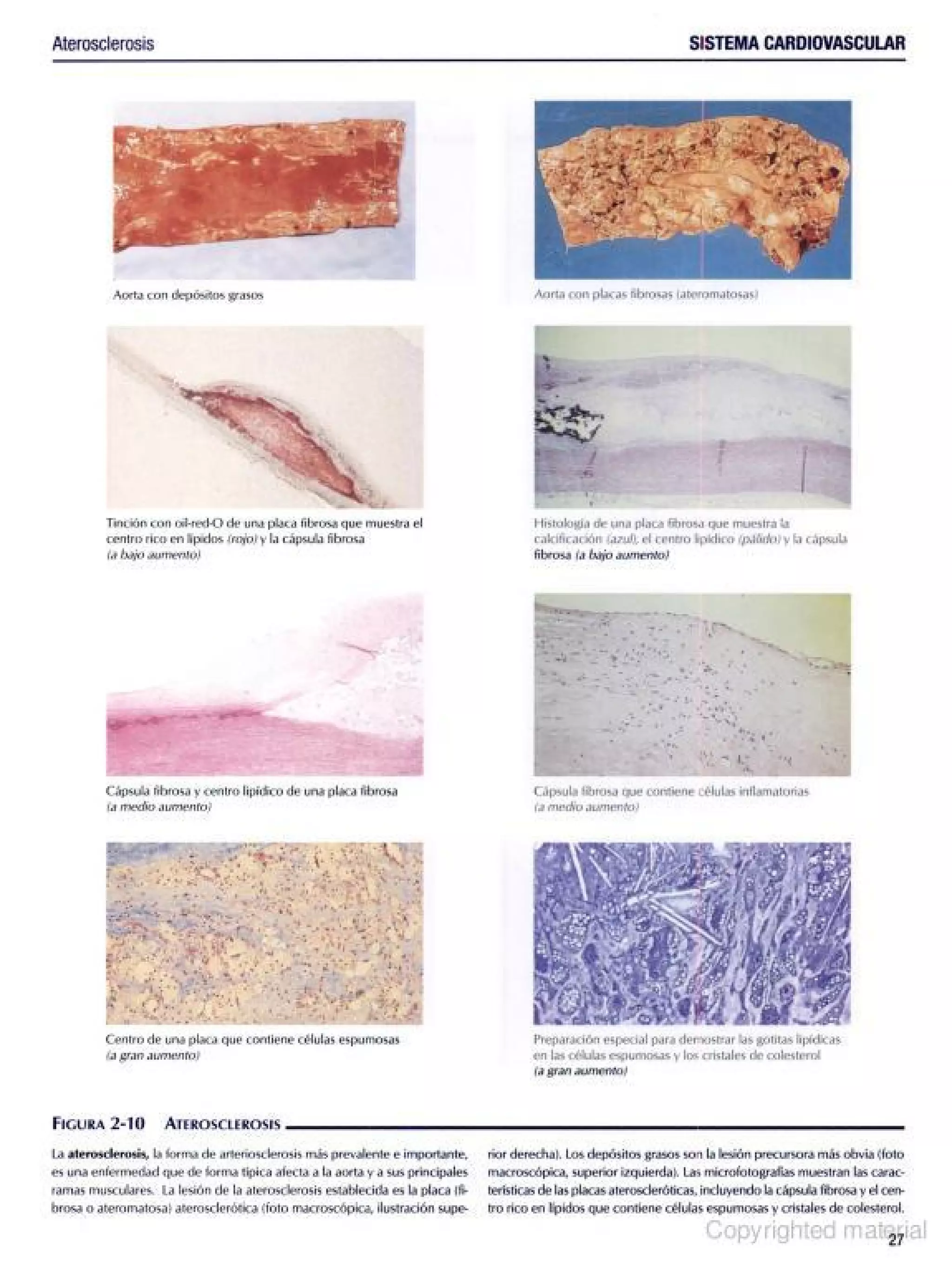 Anatomía Patólogica - Netter.pdf