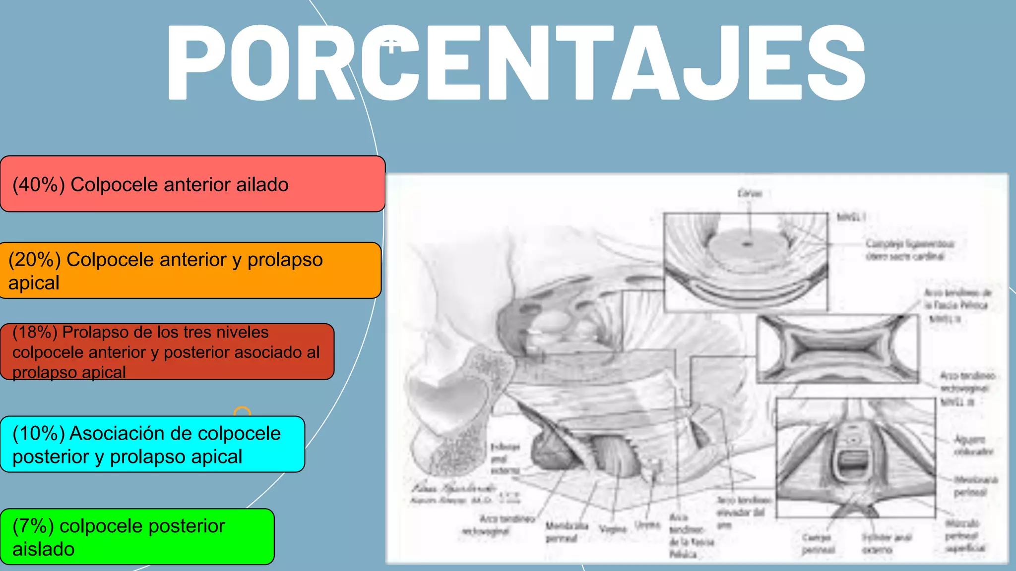 Anatomía patológica de los prolapsos genitourinarios tipos de prolapso.pdf