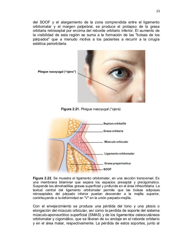 Orbitomalar