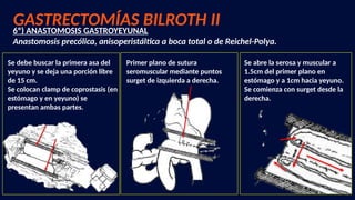 ANATOMÍA QUIRÚRGICA DEL ESTÓMAGO. GASTRECTOMÍAS.pptx