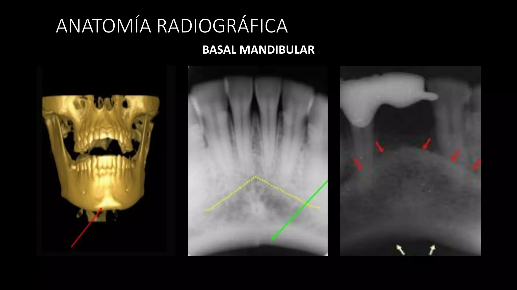 ANATOMÍA RADIOGRAFICA MAXILAR INFERIOR | PPT