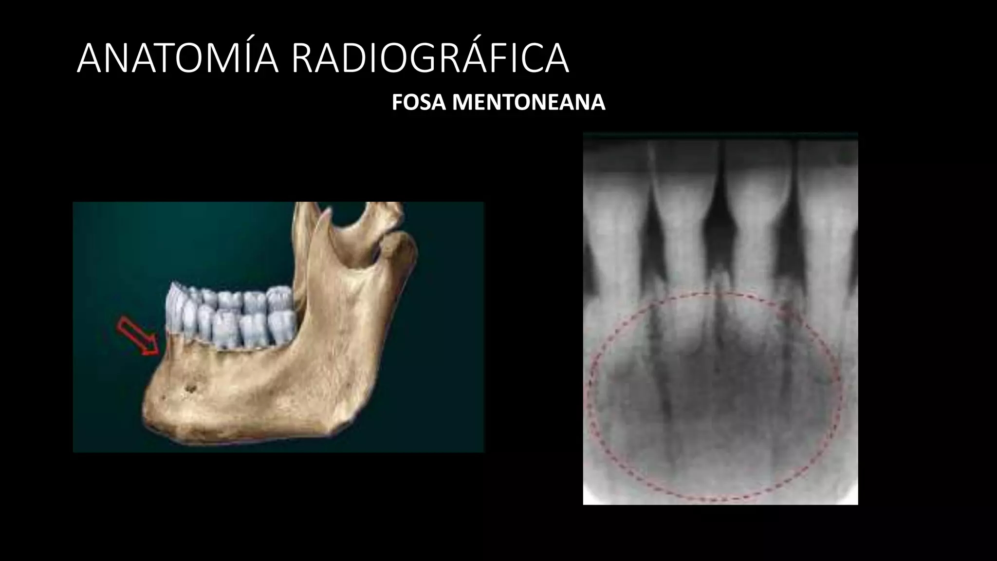 ANATOMÍA RADIOGRAFICA MAXILAR INFERIOR | PPT
