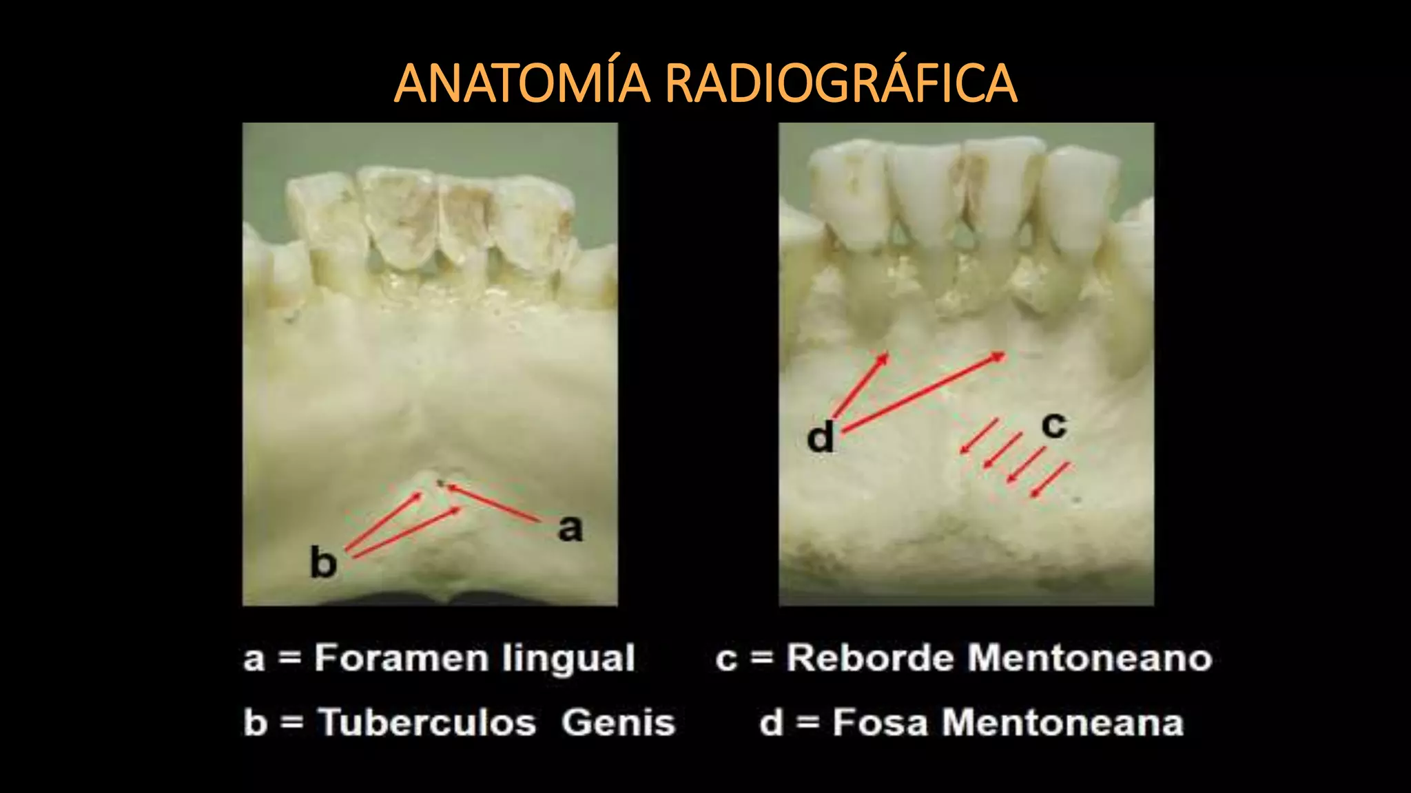 ANATOMÍA RADIOGRAFICA MAXILAR INFERIOR | PPT