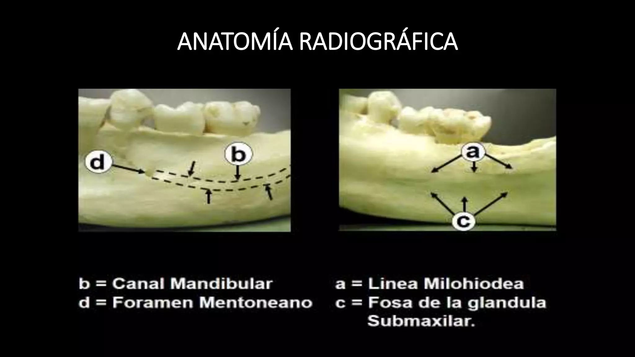 ANATOMÍA RADIOGRAFICA MAXILAR INFERIOR | PPT