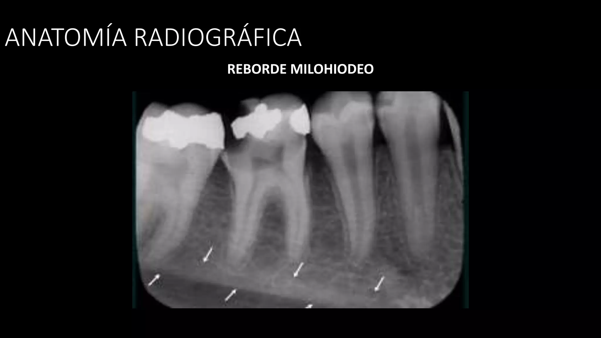 ANATOMÍA RADIOGRAFICA MAXILAR INFERIOR | PPT