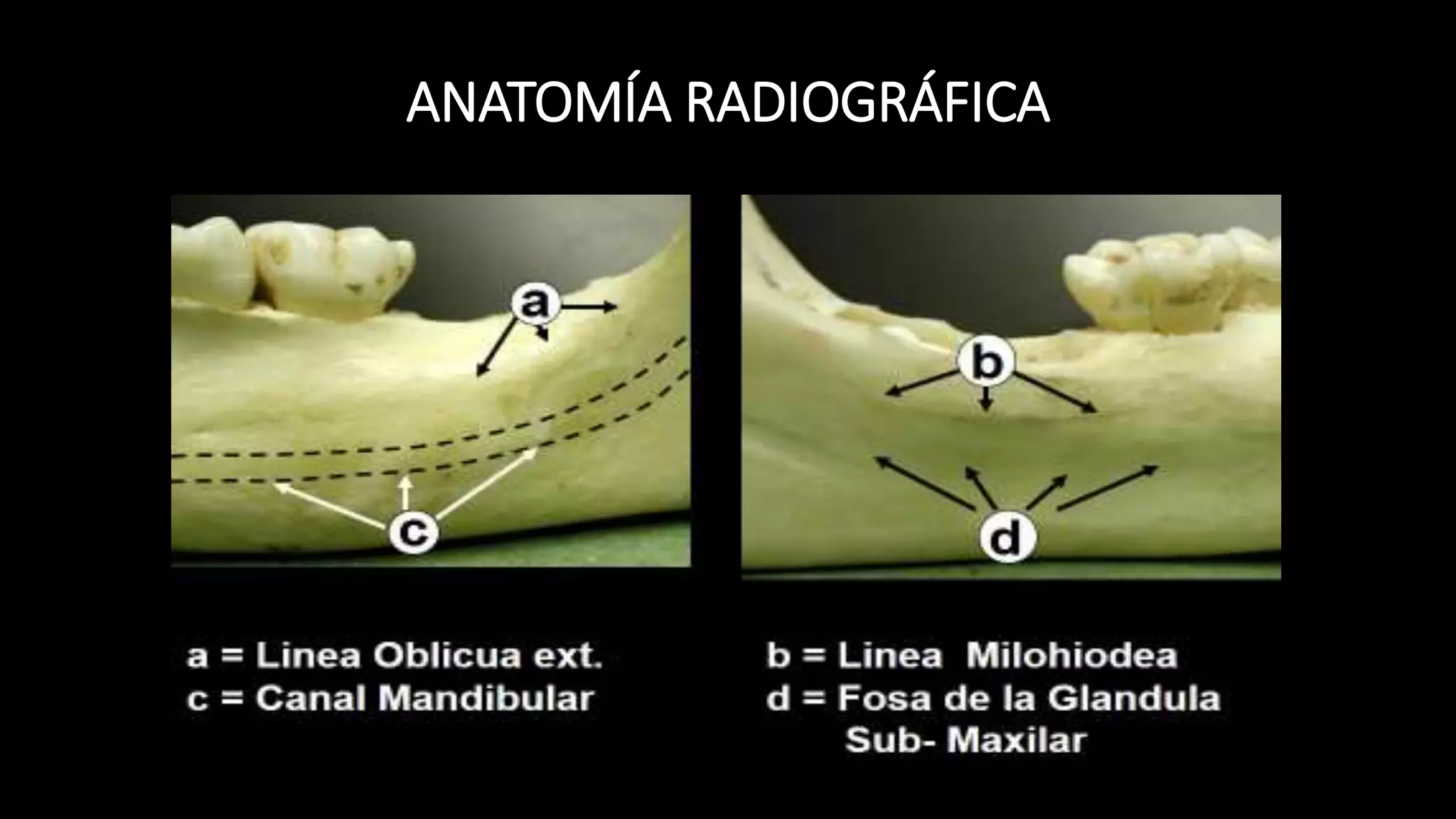 ANATOMÍA RADIOGRAFICA MAXILAR INFERIOR | PPT