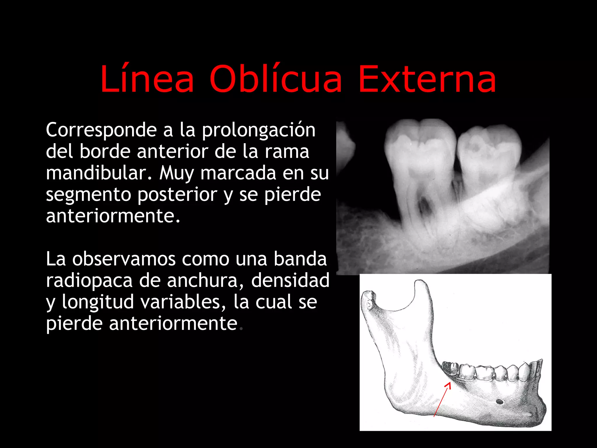 Anatomía radiográfica normal maxilar superior | PPT