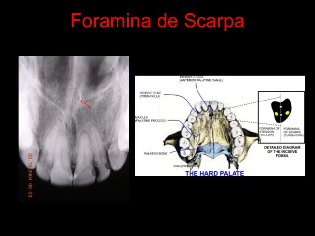 RD_1: Anatomía radiográfica dentomaxilar normal y patológica