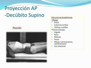 Anatomía Radiológica de Abdomen | PPTX