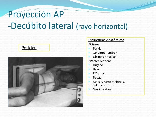 Anatomía Radiológica de Abdomen
