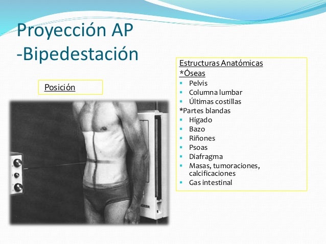 Anatomía Radiológica de Abdomen