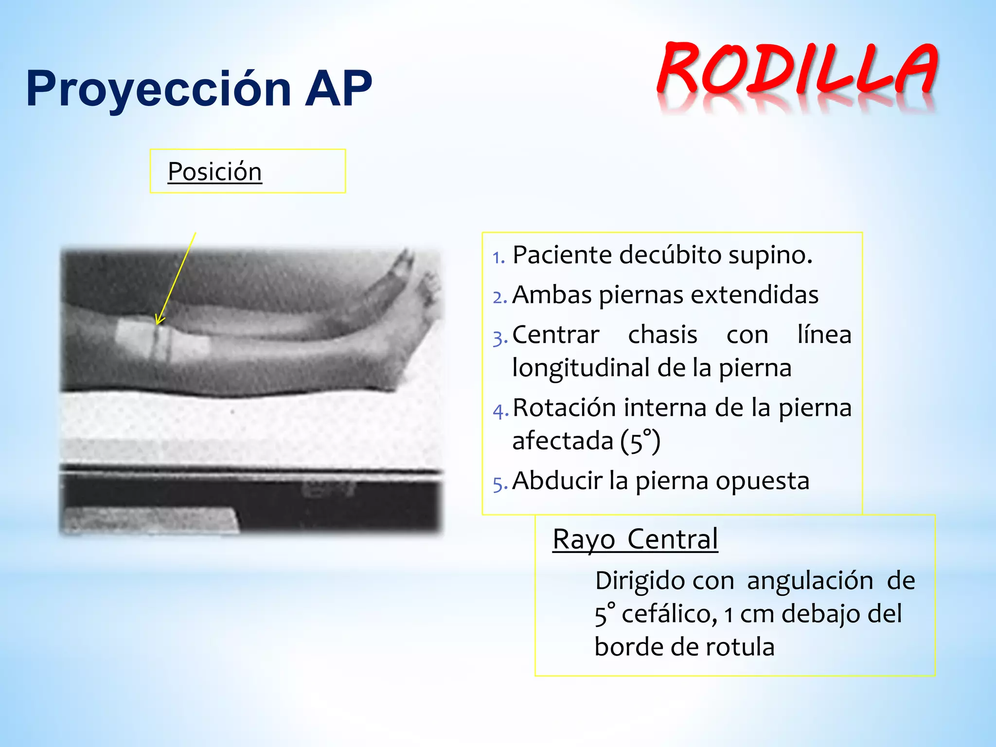 Anatomía radiológica de extremidad inferior | PPTX