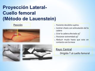 Anatomía radiológica de extremidad inferior | PPTX