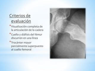 Anatomía radiológica de extremidad inferior | PPTX