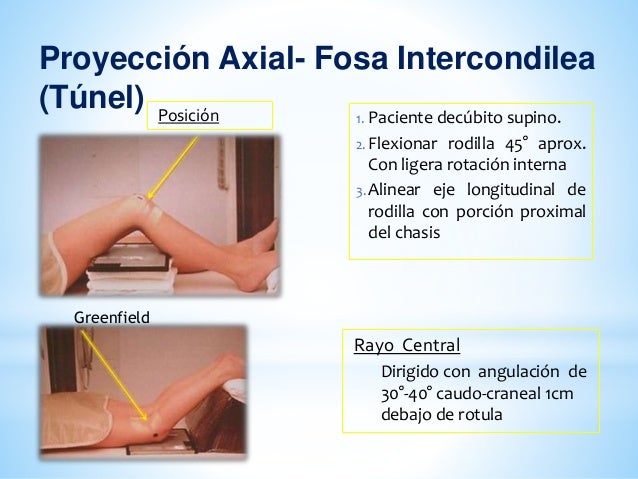 Anatomía radiológica de extremidad inferior