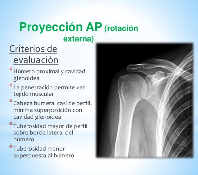 Anatomía radiológica de extremidad superior