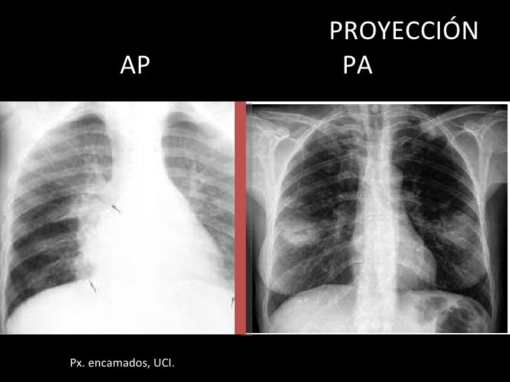 Anatomía radiológica de tórax