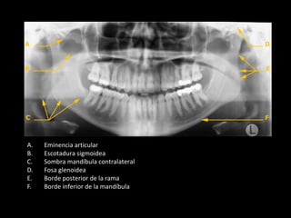 Anatomía radiológica extraoral | PPT