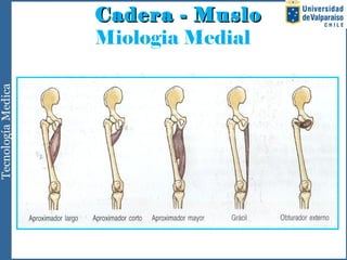 Anatomía radiológica sistema musculo esquelético ii. eeii y cintura ...