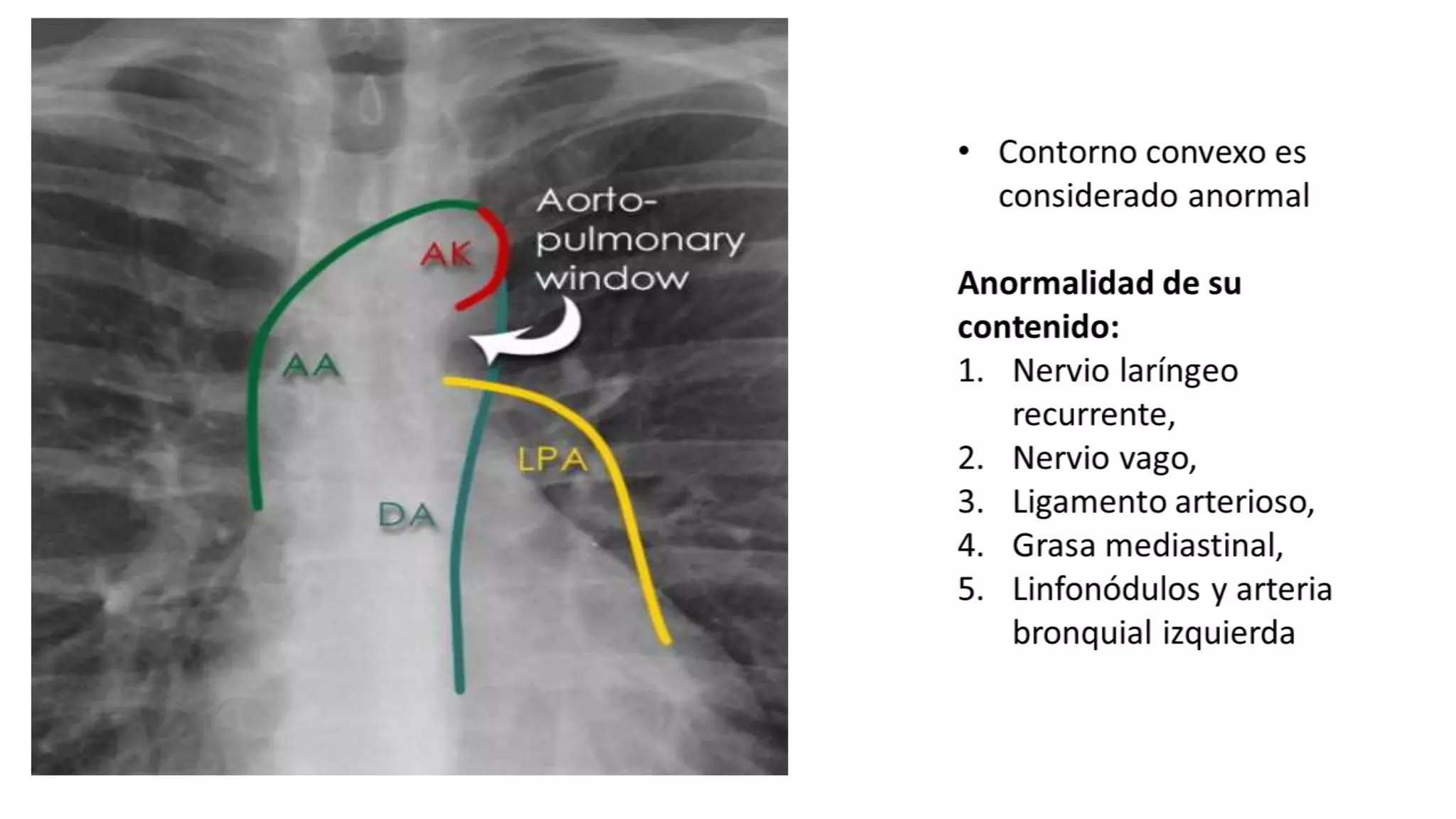 ANATOMÍA RADIOLÓGICA Y PROYECCIONES DE RX DE TÓRAX.pptx