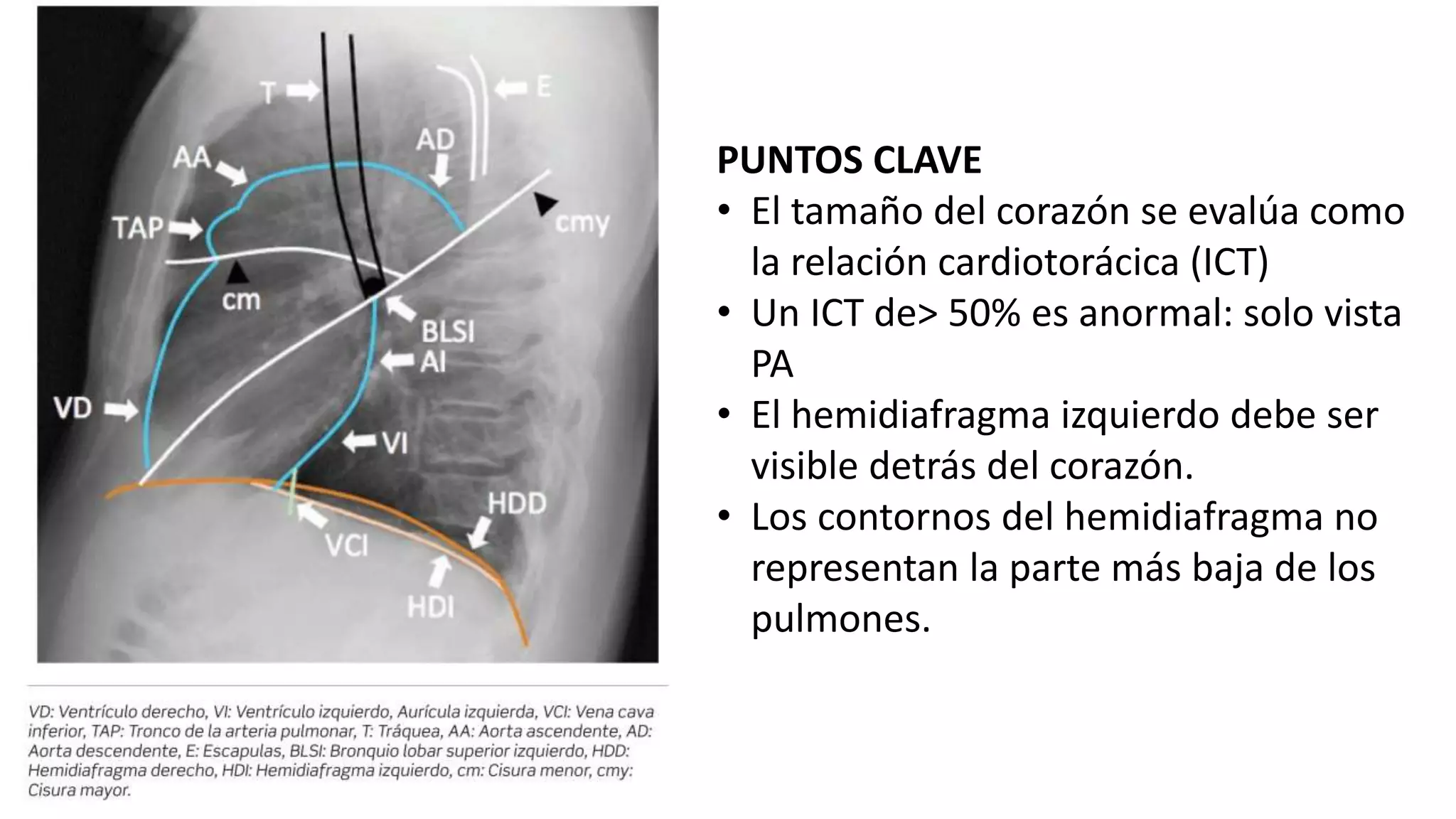 ANATOMÍA RADIOLÓGICA Y PROYECCIONES DE RX DE TÓRAX.pptx