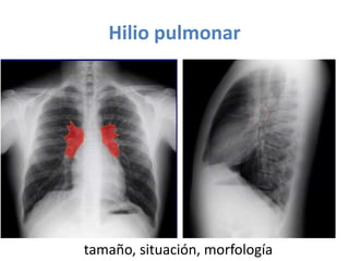 Anatomía Radiológica Neumológía | PPTX | Lung and Respiratory Health ...