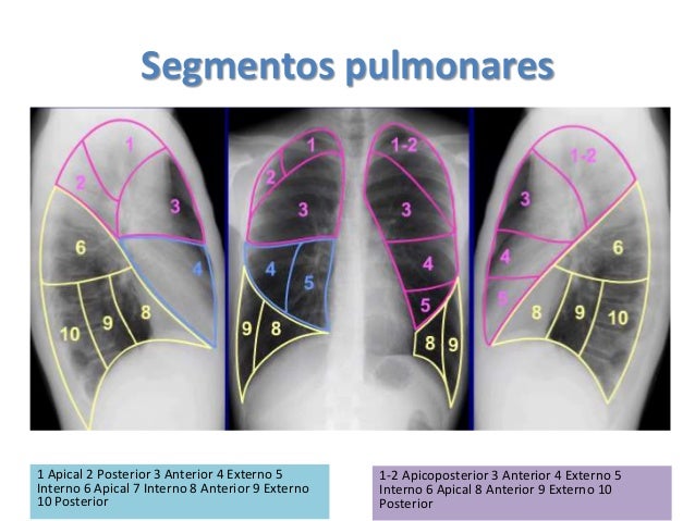 Anatomía Radiológica Neumológía