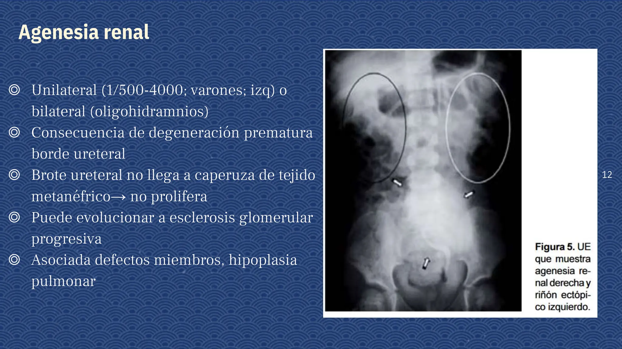 ANATOMIA RENAL/DESCRIPCION RENAL Y FISIOLOGIA | PPTX