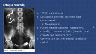 ANATOMIA RENAL/DESCRIPCION RENAL Y FISIOLOGIA | PPTX