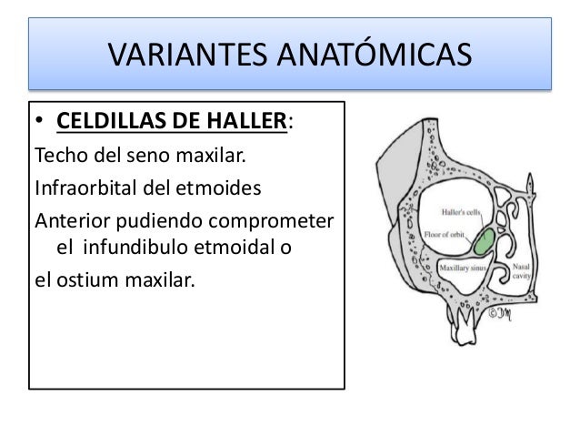 Anatomía senos paranasales
