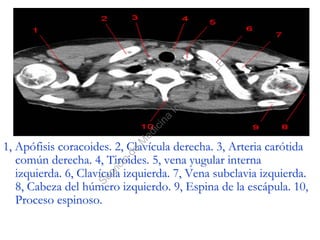 Presentación de la Anatomía TAC del Tórax.pdf