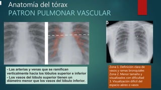 ANATOMÍA TORAX.pptx