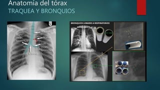 ANATOMÍA TORAX.pptx