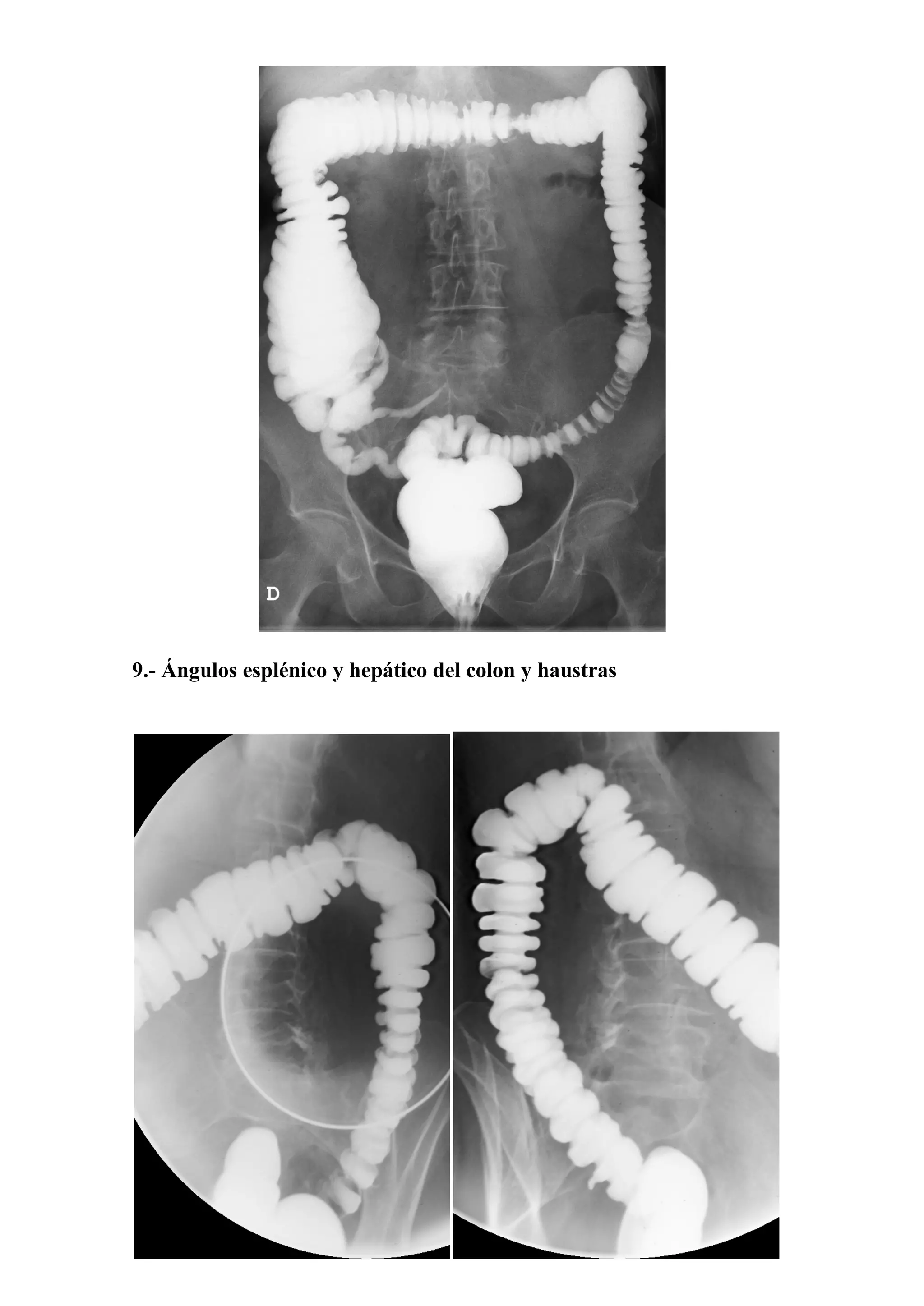 Anatomía y fisiología abdomen (I). Estómago, duodeno, intestino delgado ...