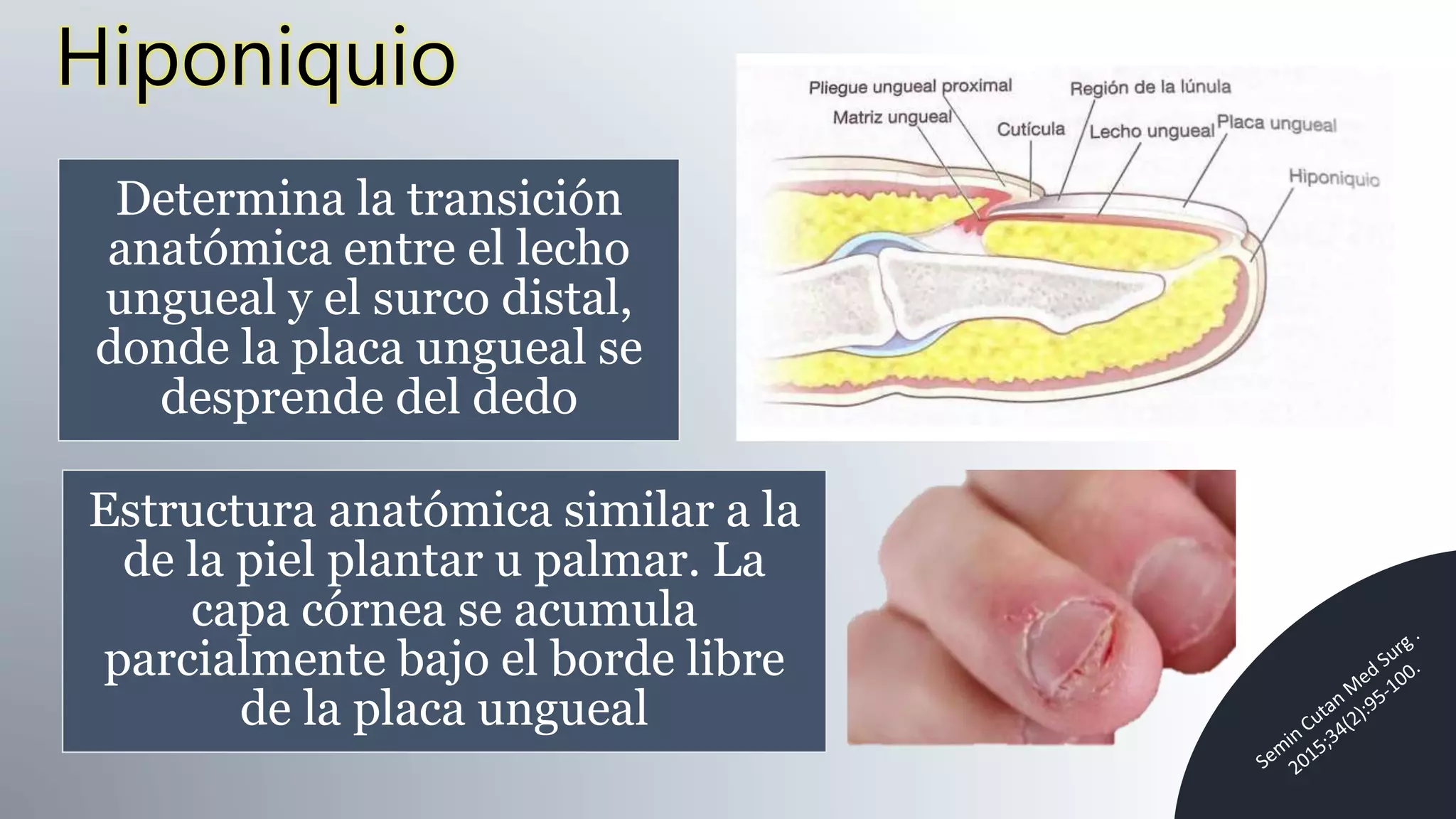 Anatomía y Fisiología de las Uñas | PPTX