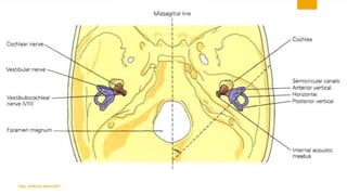 Anatomía y Fisiología del Sistema Vestibular Periférico | PPTX