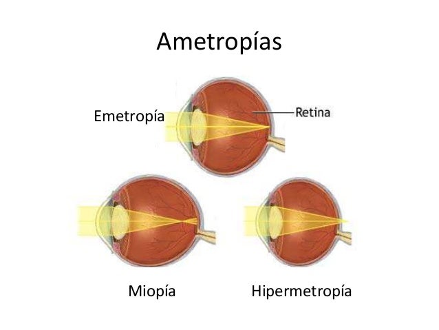 Anatomía y patología frecuente en oftalmología